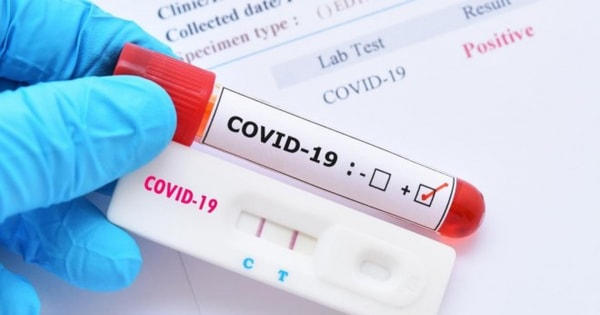 Bộ Y tế: Không thể đánh đồng tất cả các loại test kit với nhau